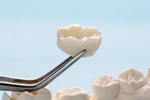 Paediatric Dental Care Gold Coast | Children’s Dentist